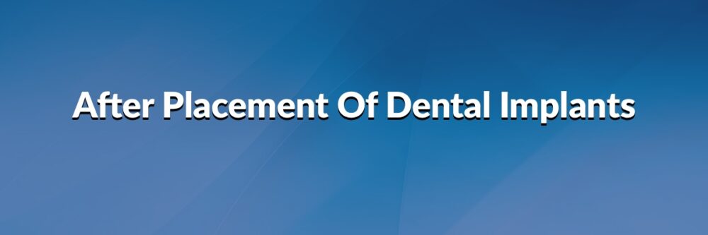 Post Operative Instructions After Dental Implants - Dr. Paul Mirdamadi