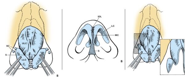Nose - Dr. Paul Mirdamadi DDS