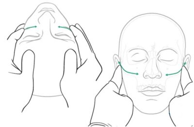 Midface - Dr. Paul Mirdamadi DDS