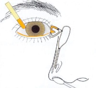 Naso-Orbital-Ethmoid Complex - Dr. Paul Mirdamadi DDS