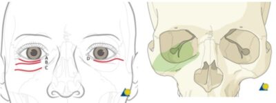 Orbit - Dr. Paul Mirdamadi DDS