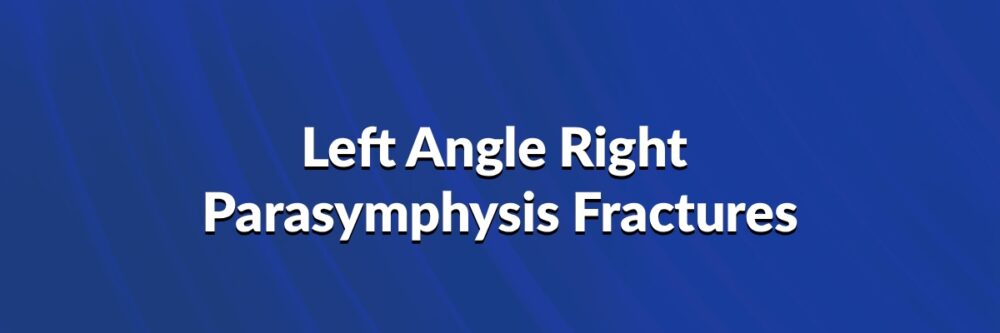 Left Angle & Right Parasymphysis Fractures - Dr. Paul Mirdamadi