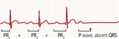 Cardiovascular System - Dr. Paul Mirdamadi DDS